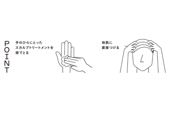 AGAって何？AGAの原因とスカルプケアについて解説！ | DEMI LABO（デミラボ）