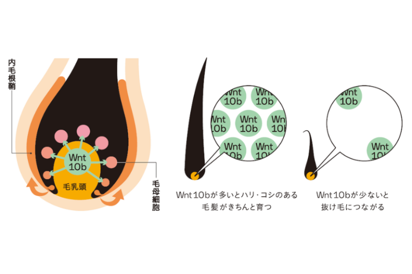 AGAって何？AGAの原因とスカルプケアについて解説！ | DEMI LABO（デミラボ）